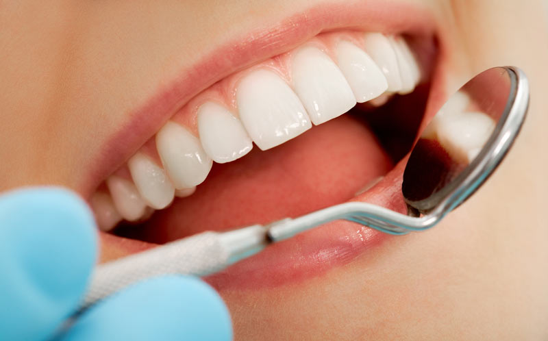 Direct vs. Indirect Restorations: What's the Difference?